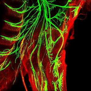 Blog: Operation Neuroprotection | ALS TDI