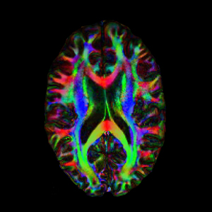 Blog: Power Up | ALS Therapy Development Institute