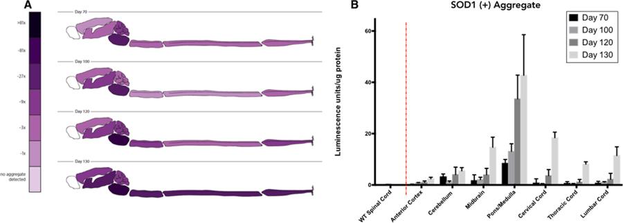 Blog: SOD1 protein aggregation predicts slower ALS progre... | ALS TDI