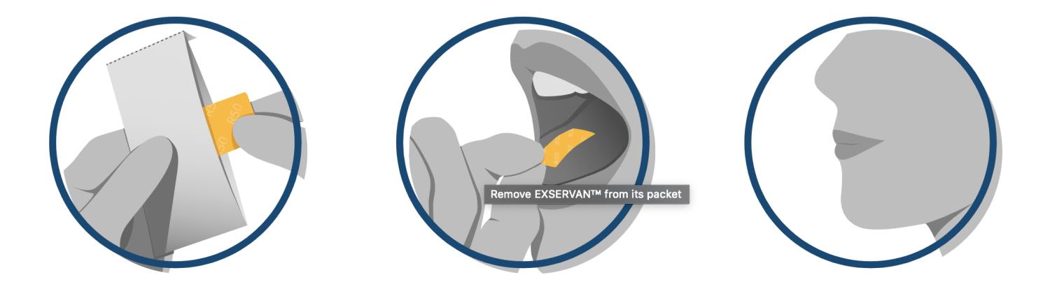 Blog: Exservan™, a New Riluzole Formulation, Provides New... | ALS TDI