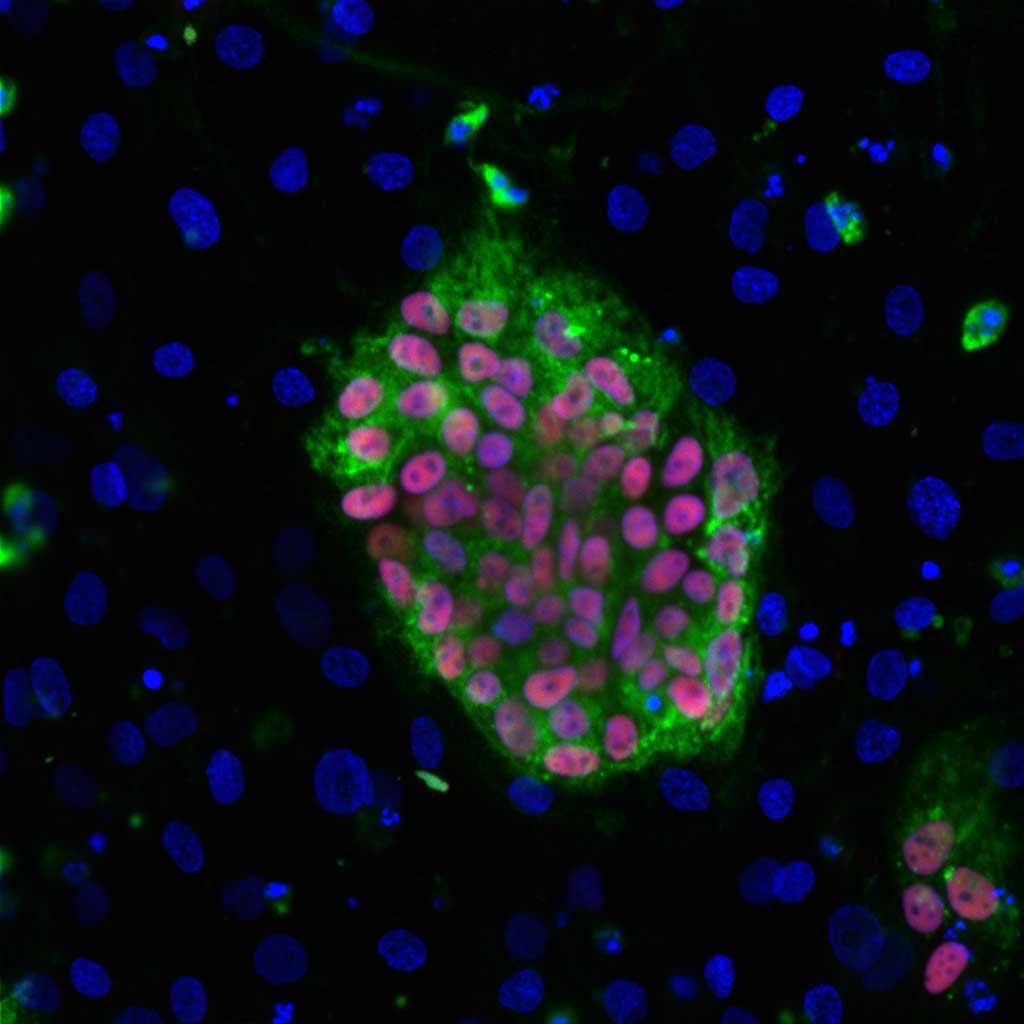 Blog: Induced Pluripotent Stem Cells at ALS TDI | ALS TDI